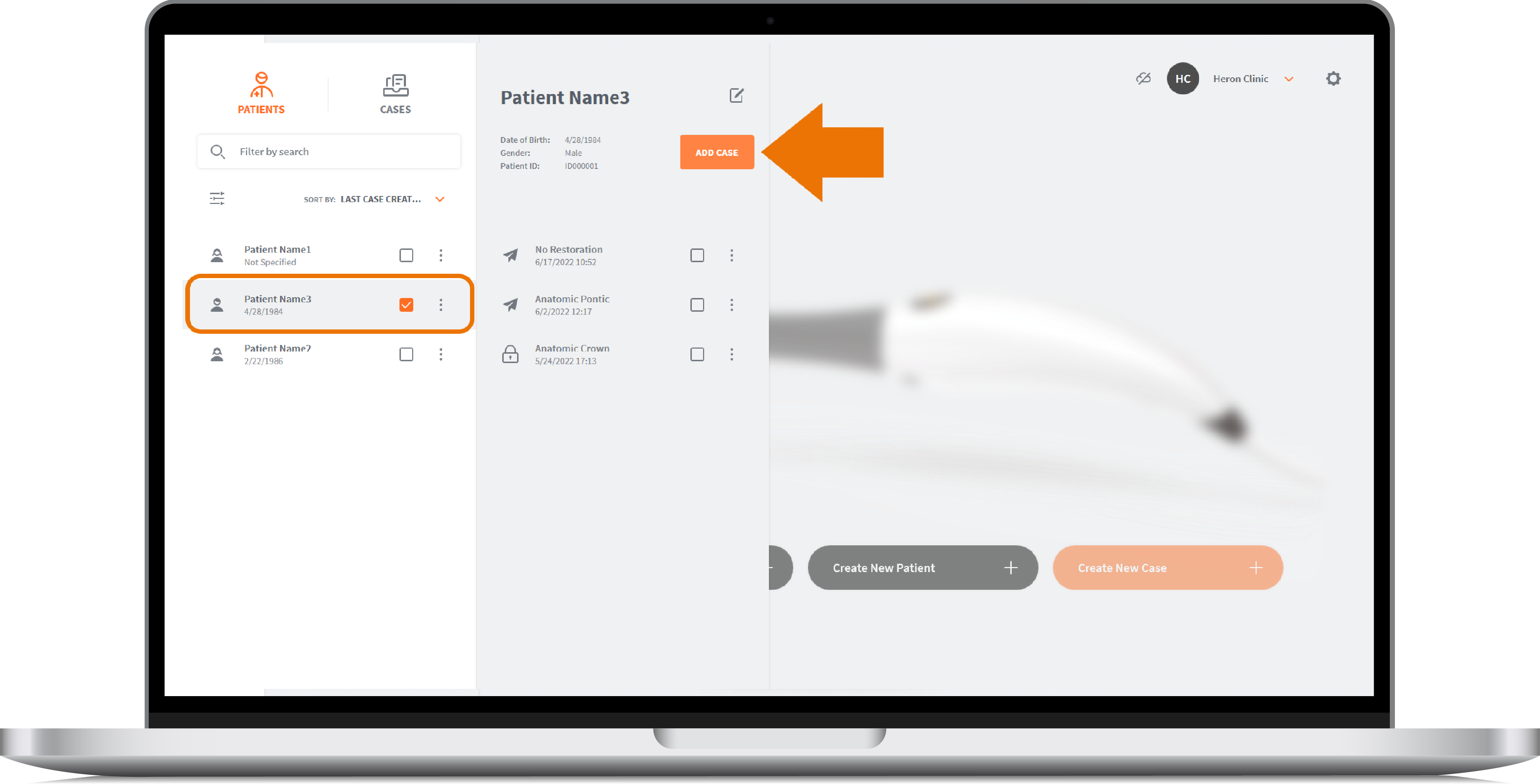 The 3DISC™ IOS Workflow - 3DISC Online Help