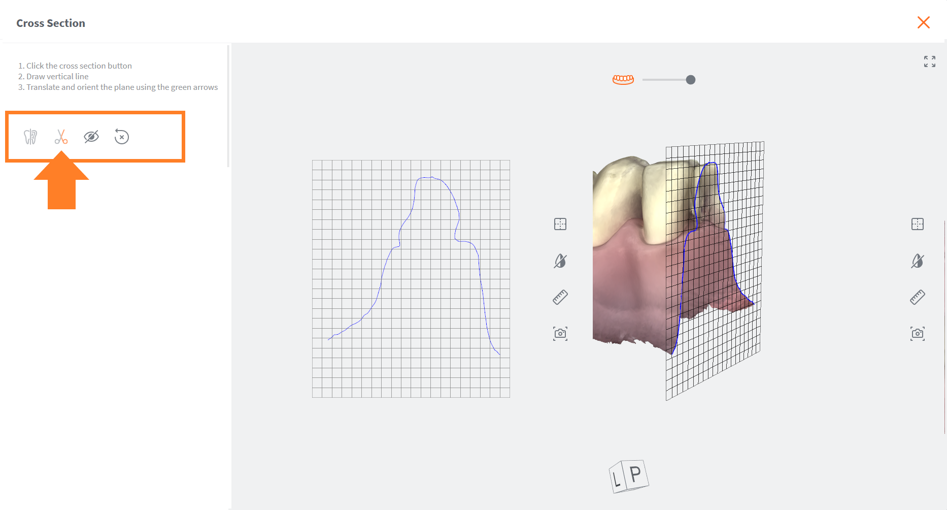 Using Case Review Tools - 3DISC Online Help