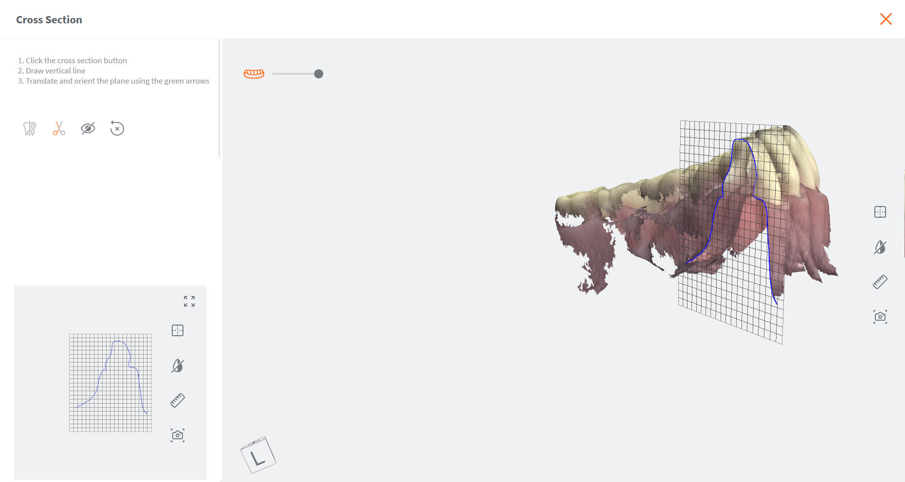 Using Case Review Tools - 3DISC Online Help