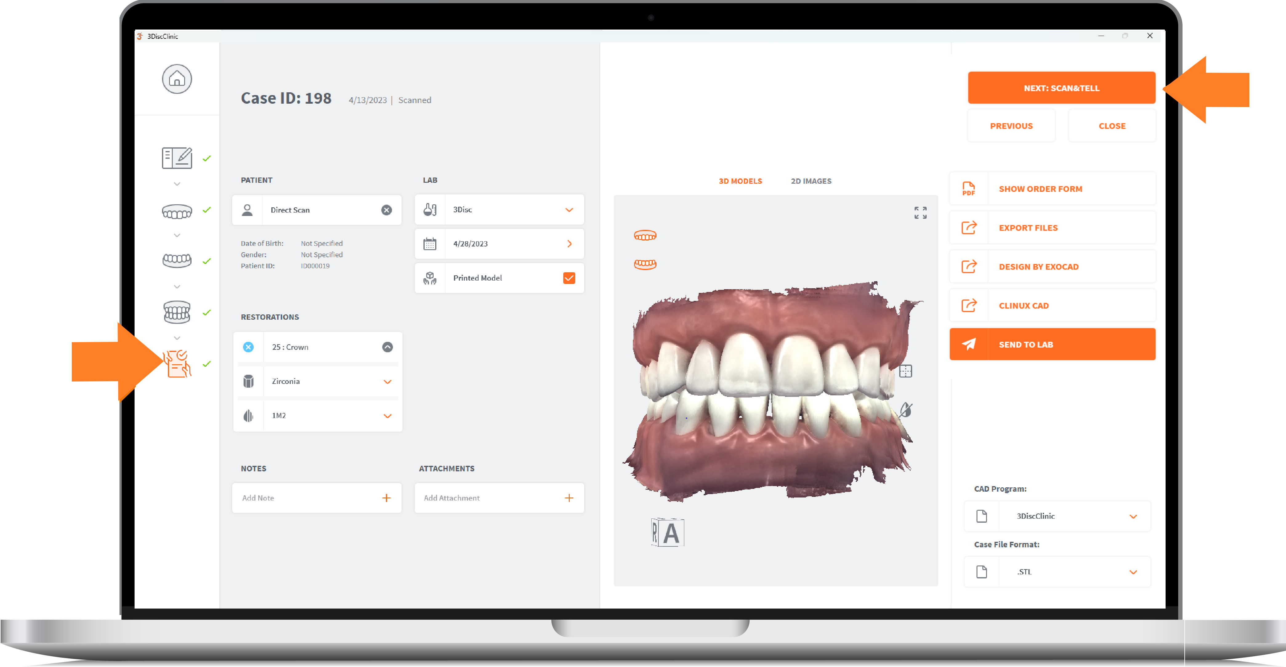 Case Review - 3DISC Online Help