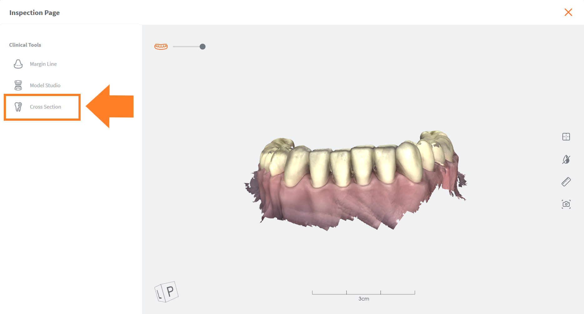 Using Case Review Tools - 3DISC Online Help