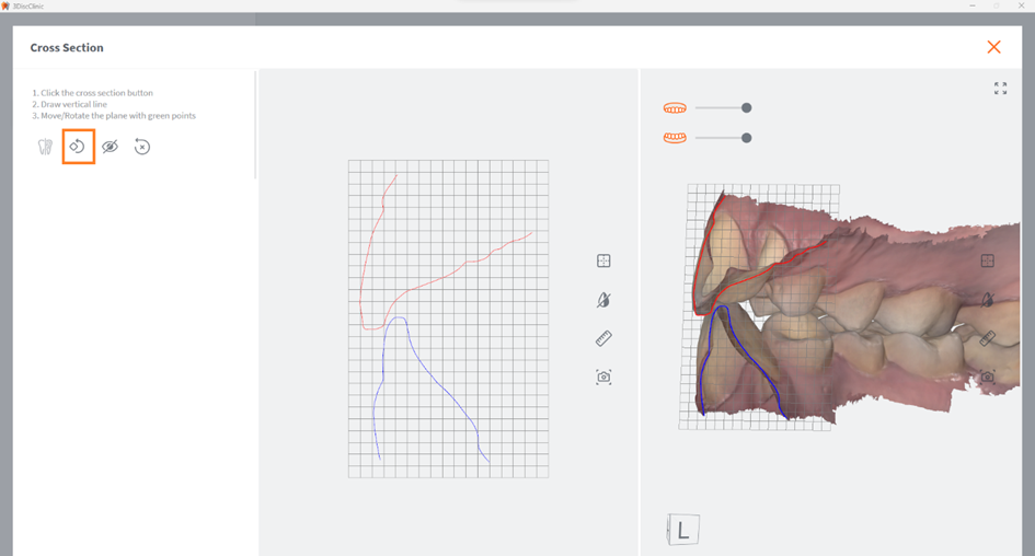 What’s New in 3DiscClinic™ 4.0 - 3DISC Online Help