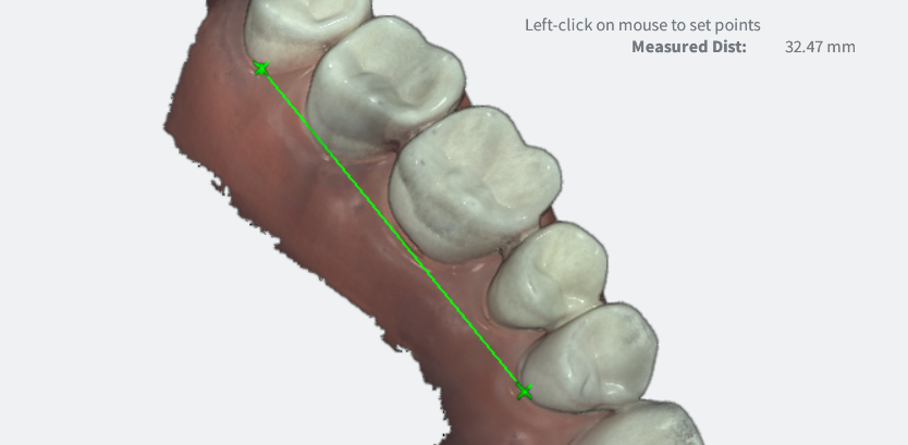 3DiscClinic™ Live Scan Tools - 3DISC Online Help