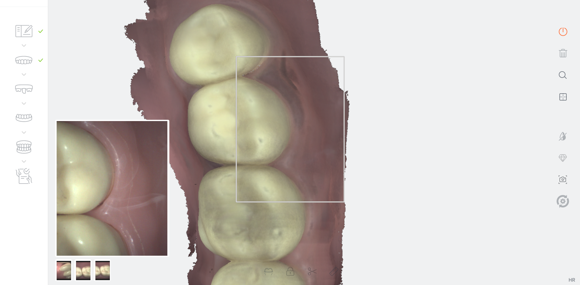 Scanning the Maxillary Arch - 3DISC Online Help