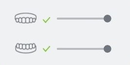 Automatic Bite Alignment - 3DISC Online Help
