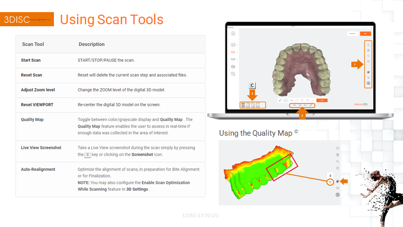 The 3DISC™ IOS Workflow - 3DISC Online Help