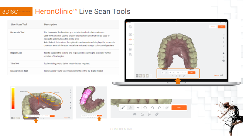 The 3DISC™ IOS Workflow - 3DISC Online Help