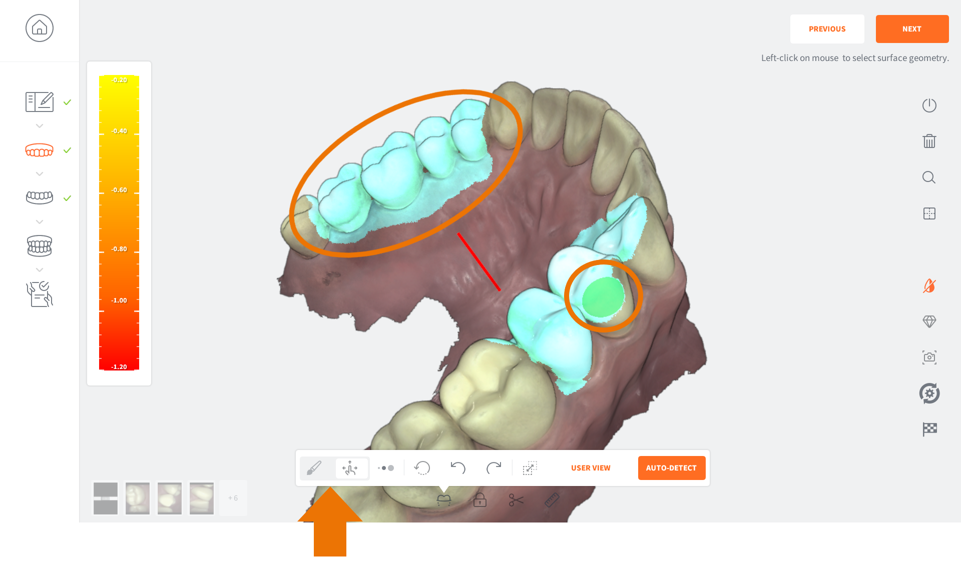 3DiscClinic™ Live Scan Tools - 3DISC Online Help