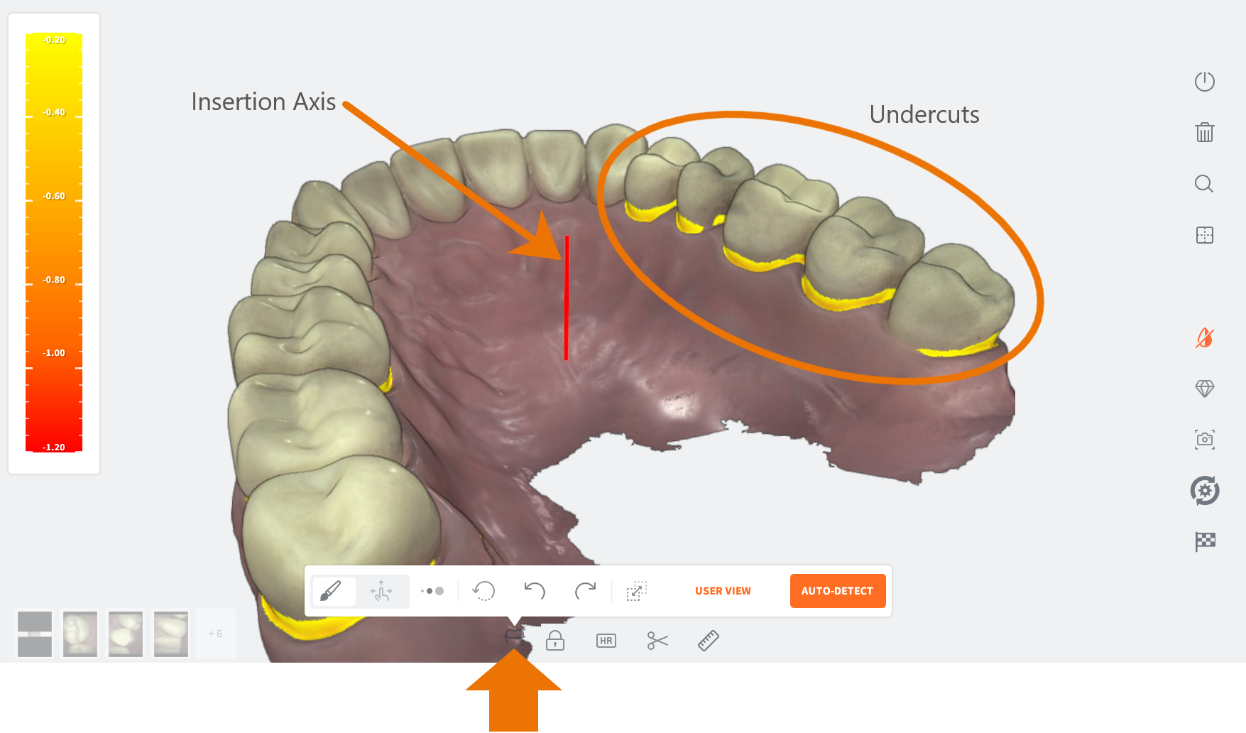 3DiscClinic™ Live Scan Tools - 3DISC Online Help
